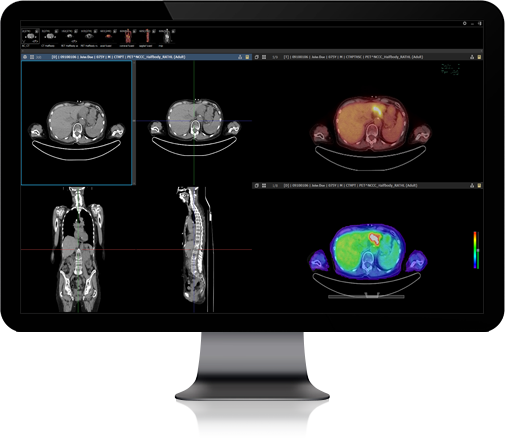 인피니트헬스케어